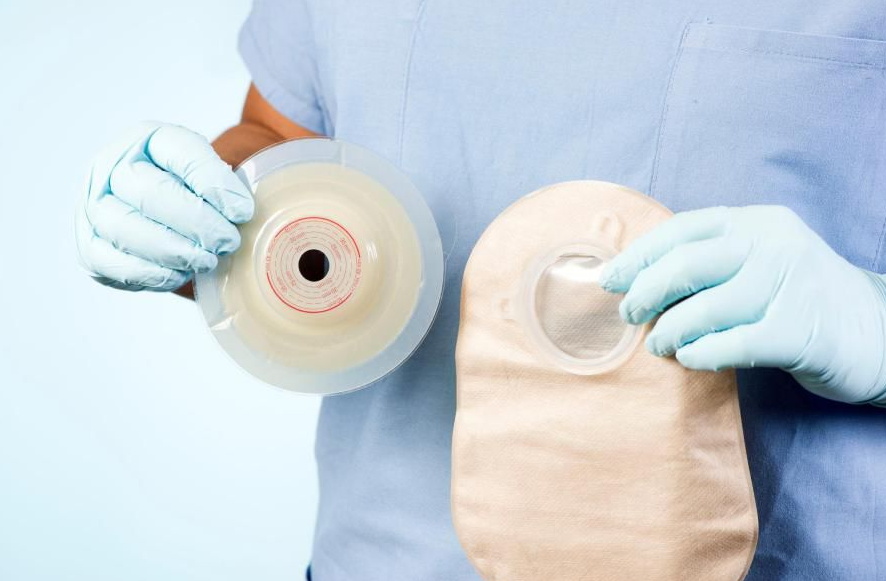 Ostomy Bags - jinyemed.com