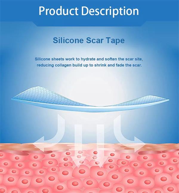 Silicone Scar Dressing - jinyemed.com